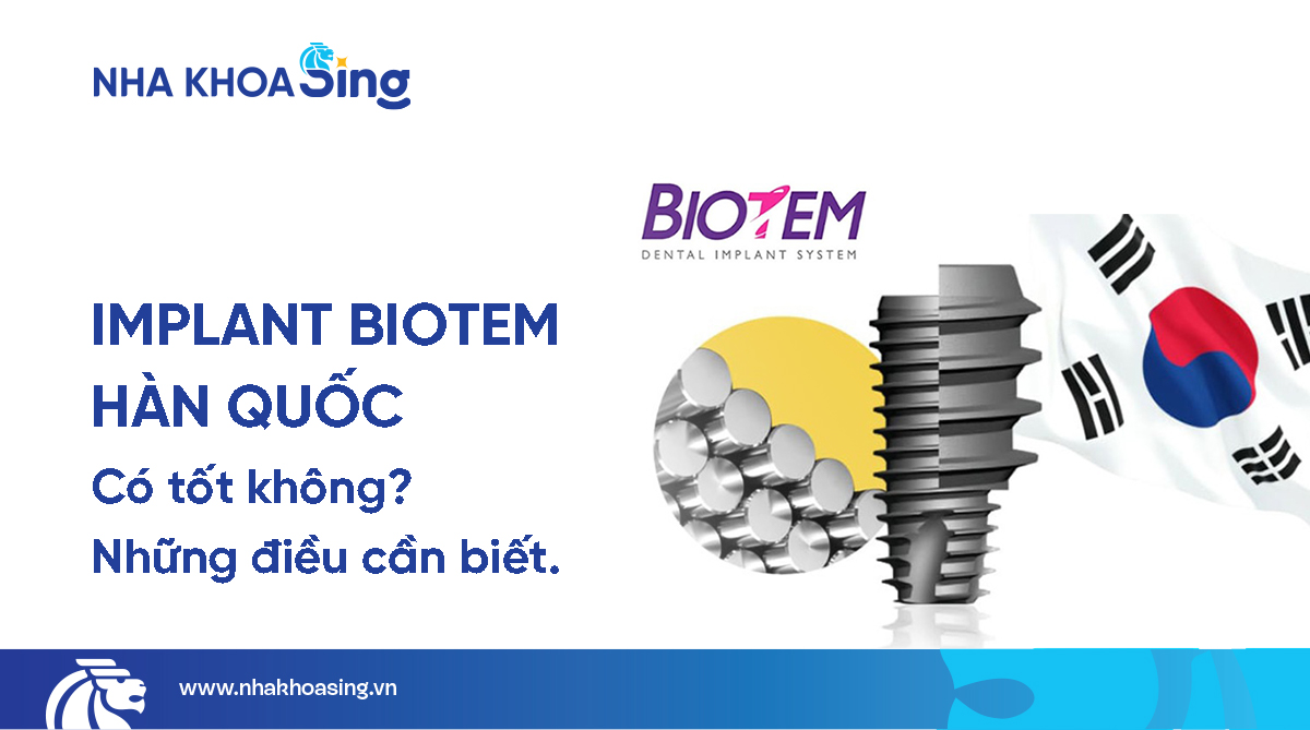 Trụ Implant Biotem có tốt không? Những thông tin cần biết