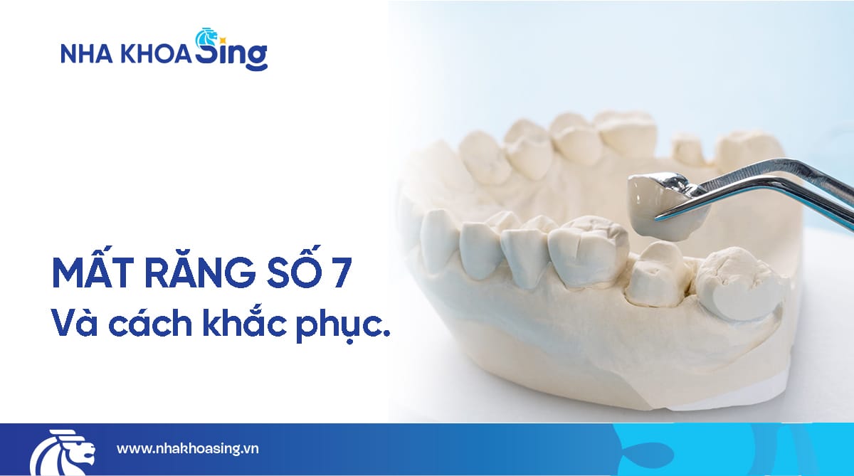 Mất răng số 7 hàm dưới có sao không? Cách khắc phục an toàn